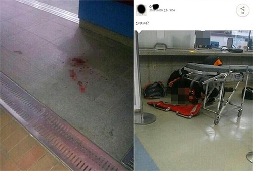 [ss현장] 동대구역 30대男 성기 절단 현장 사진에 경악 사회 기사 더팩트